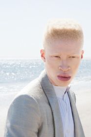 Shaun Ross The First Afro American Male Model Born With Albinism Shaun Ross The First Afro American Male Model Born With Albinism